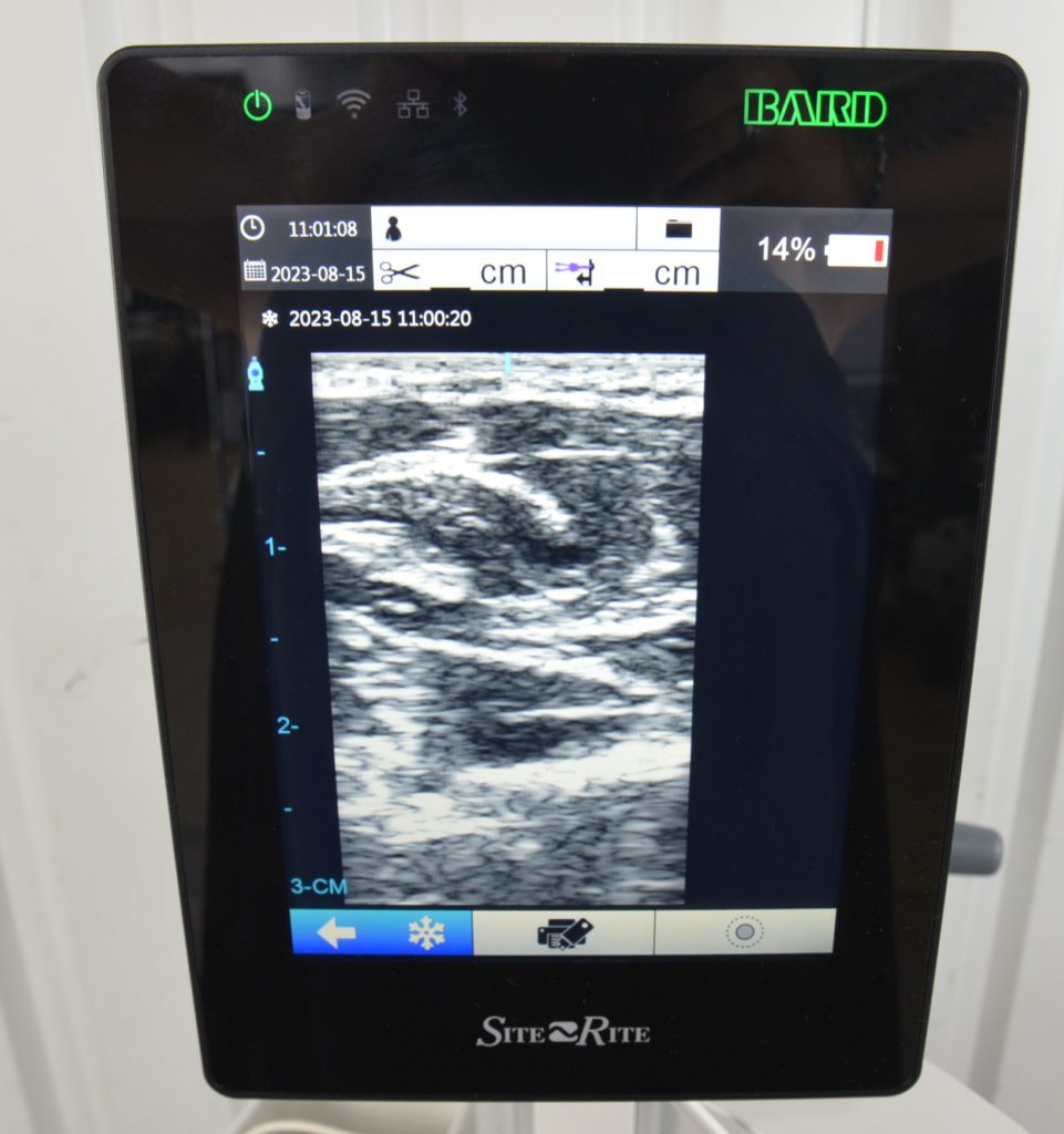 BARD SiteRite 8 Ultrasound System Pinpoint GT Technology W/ Transducer ...
