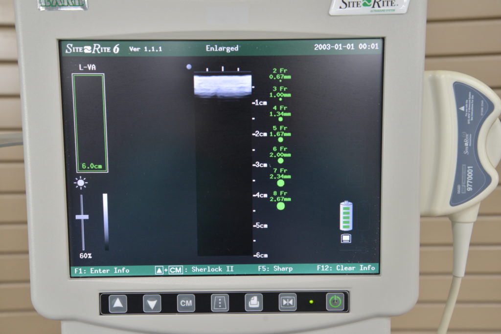 Bard SiteRite 6 Ultrasound System 9770066 W/ Transducer 9770001 ...