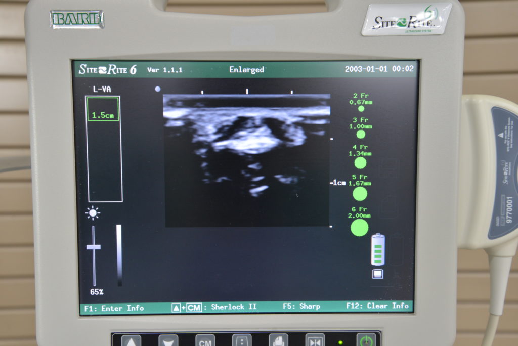 Bard SiteRite 6 Ultrasound System 9770066 W/ Transducer 9770001 ...