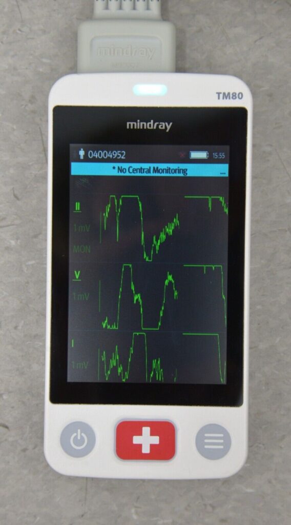 Mindray BeneVision TM80 Mini Telemetry Monitor W/ Masimo SpO2 & 5-Lead ...