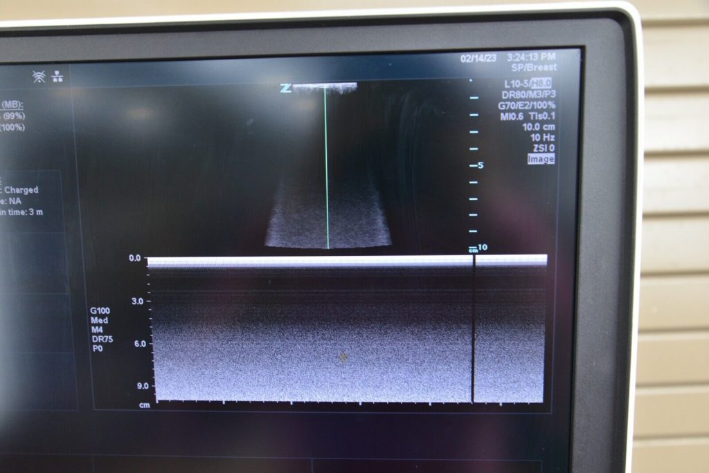 Zonare Mindray ZS3 Ultrasound System REF 88000-00 with Mobile Cart ...