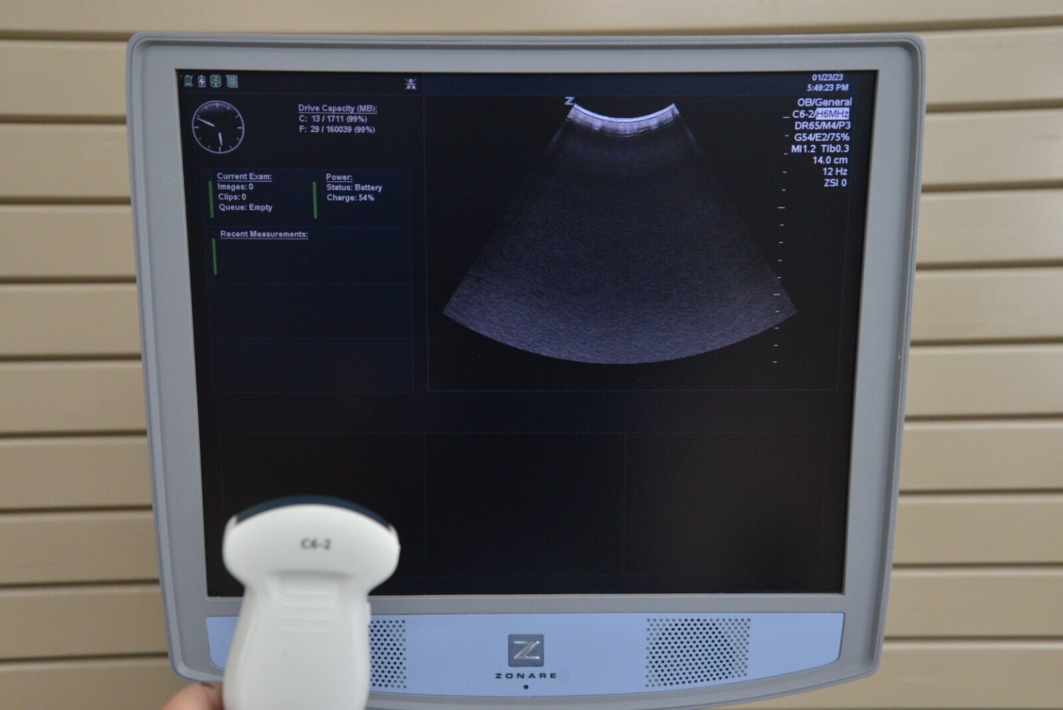 Zonare Ultra Z.one Diagnostic Ultrasound System w/Z.one Scan Engine ...