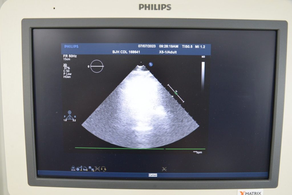 Philips IE33 Diagnostic Imaging System 8500-0082 W/ Philips X5-1 Matrix ...