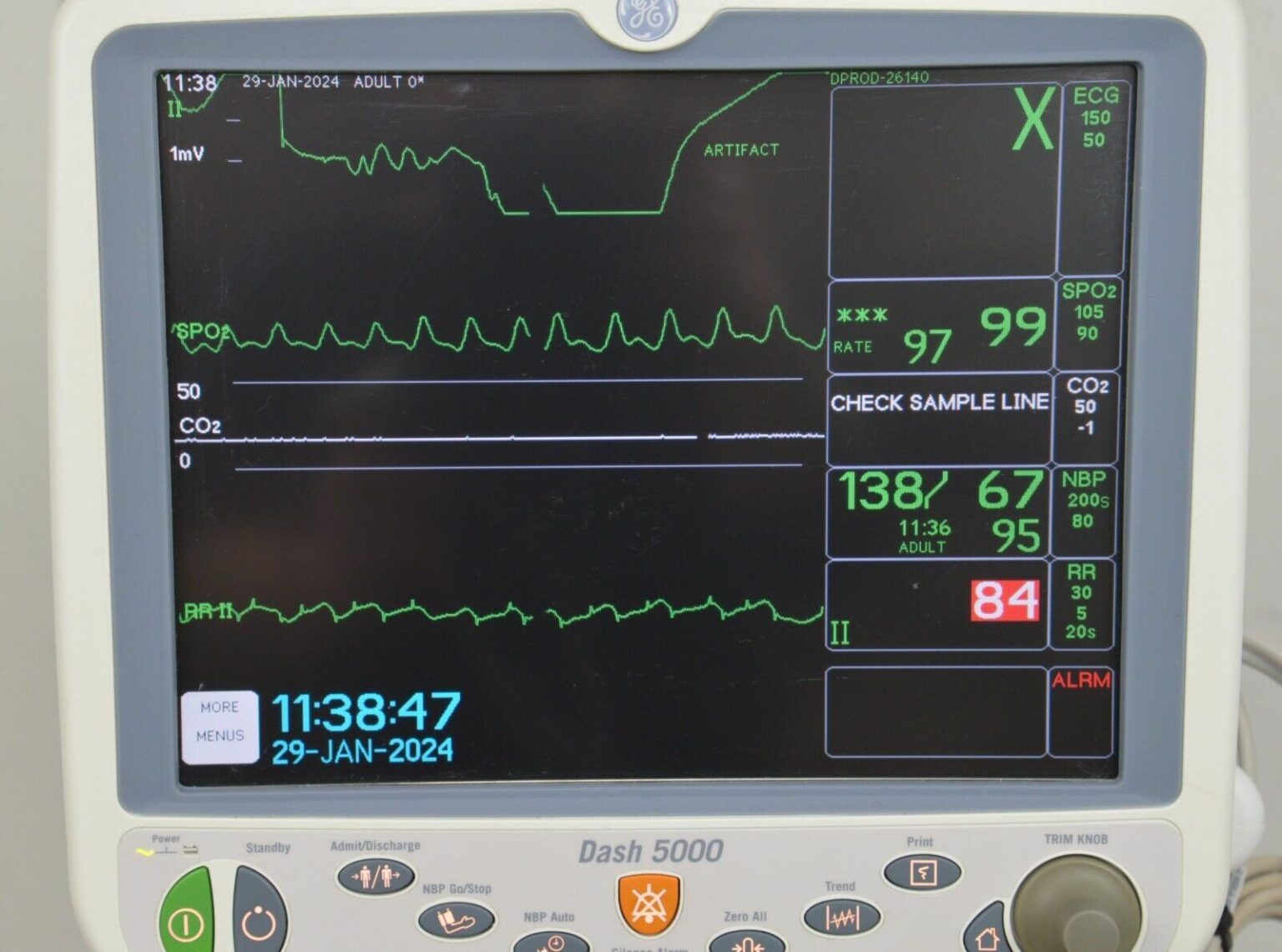 GE Dash 5000 Patient Monitor ECG, SpO2, NBP, Temp, and Printer 2035598 ...