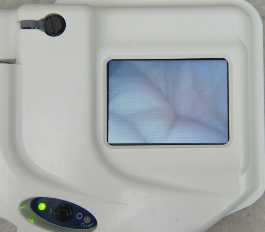 Verathon GlideScope Ranger Video Laryngoscope 0570-0186 W/ Blade 0574 ...