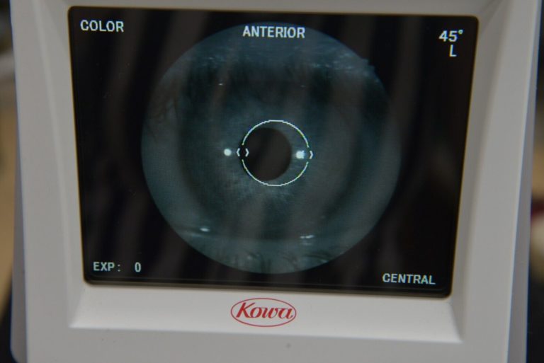 KOWA nonmyd 8s Retinal Fundus Camera – Rhino Trade LLC