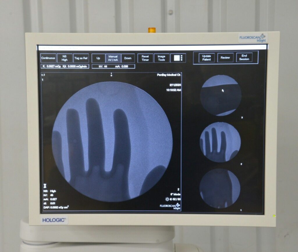 2011 Hologic Fluoroscan InSight 2 C-Arm Imaging X-Ray System with ...