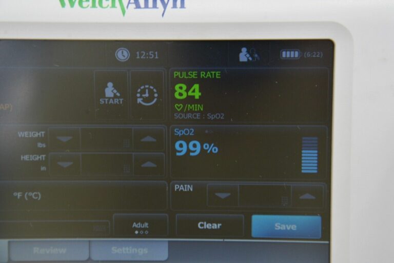Welch Allyn 71WT Connex Spot Vital Signs Monitor Core REF 901058 ...