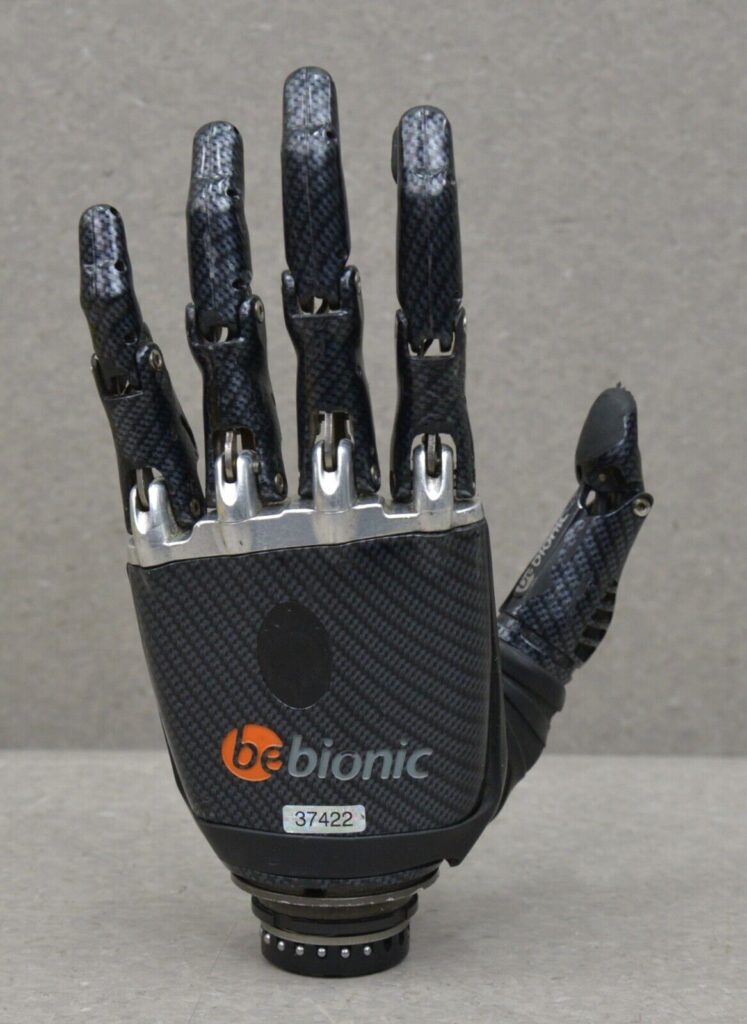 Ottobock Bebionic Myoelectric Prosthetic Hand, Left Hand RSL-RP609 ...