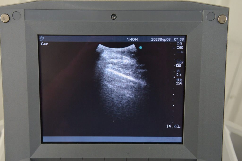 SonoSite Titan High-Resolution Ultrasound System W/ Transducer C60/5-2 ...
